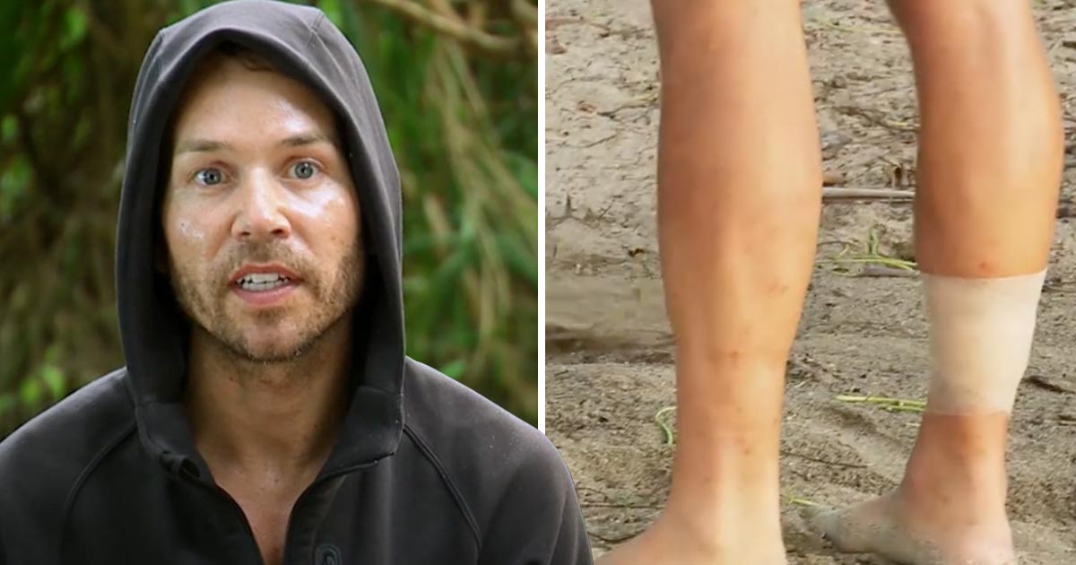 Robinson-Simon Hallin om okända skadan